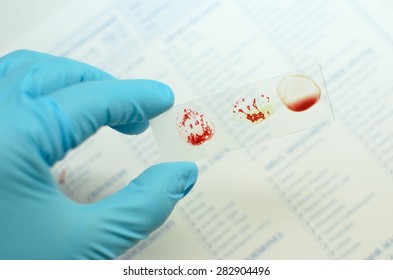 Blood Group Testing By Using Slide Stock Photo 282904496 | Shutterstock
