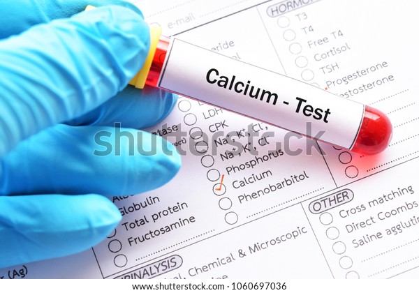Blood Sample Calcium Test Stock Photo 1060697036 | Shutterstock