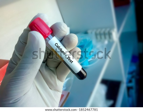 Blood Sample Calcium Test Stock Photo (Edit Now) 1852467781