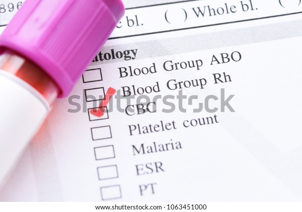 Blood Sample Complete Blood Count Cbc Foto de stock 1063451000 ...