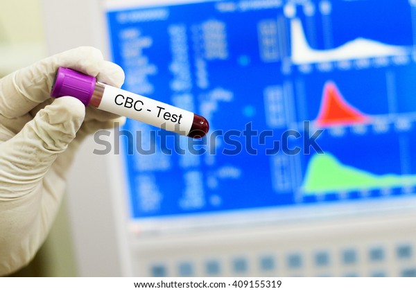Blood Sample Complete Blood Count Cbc Stock Photo 409155319 | Shutterstock