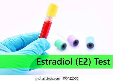 Test Tube Blood Sample Follicle Stimulating Stock Photo (Edit Now ...