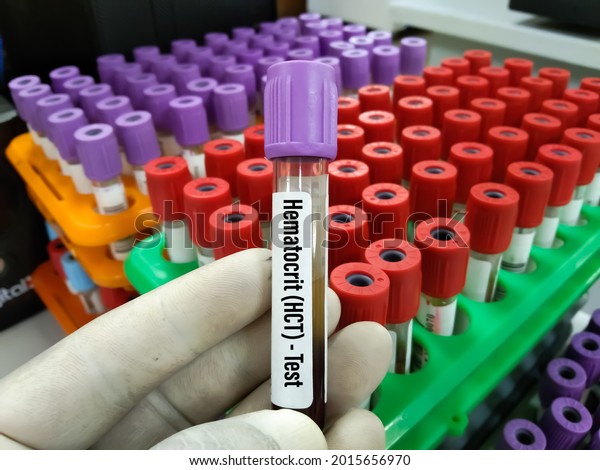 Blood Sample Hematocrithct Test Other Blood Stock Photo (Edit Now ...