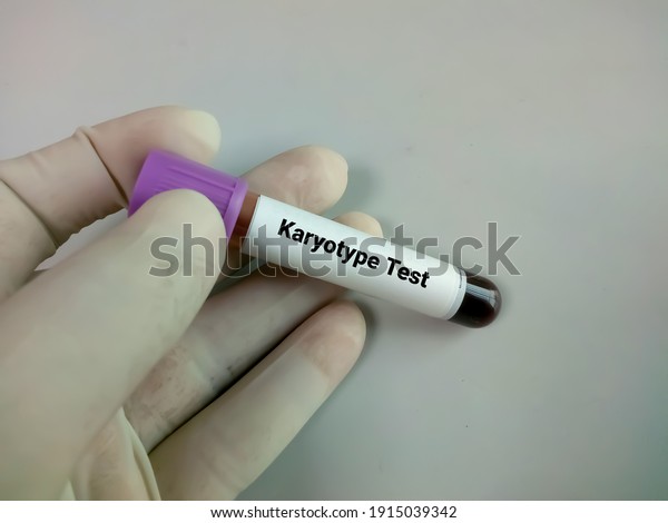 Blood Sample Karyotype Testing Study Abnormal Stock Photo (Edit Now ...