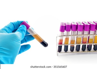 Blood Sample Laboratory Testing Stock Photo 351565607 | Shutterstock