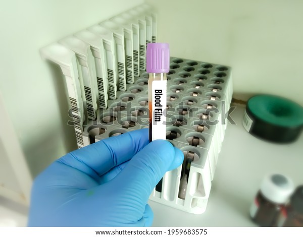 Blood Sample Lavender Tube Blood Film Stock Photo (Edit Now) 1959683575 Blood Sample Lavender Tube Blood Film Stock Photo (Edit Now) 1959683575