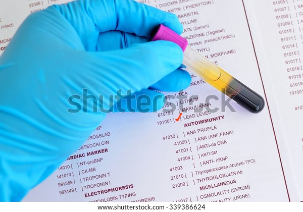 Blood Sample Lead Level Testing Stock Photo 339386624 | Shutterstock