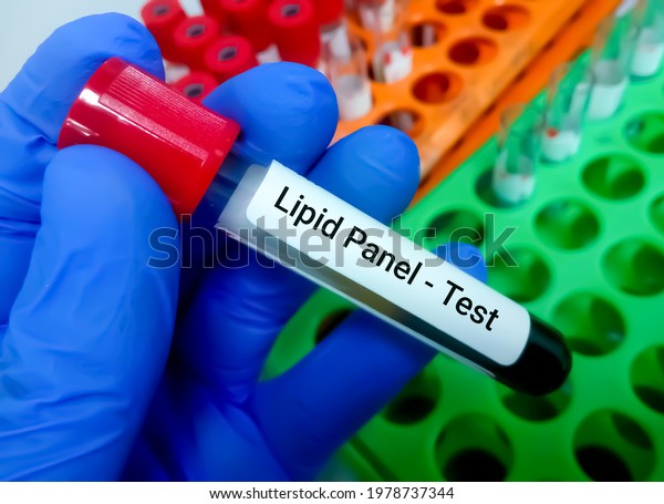 Blood Sample Lipid Panel Test Lipid Stock Photo 1978737344 | Shutterstock
