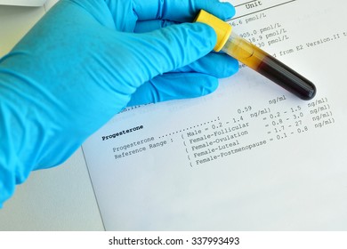 Blood Sample Requisition Form Estradiol Hormone Stock Photo 758720113 ...
