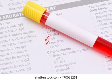 Blood Sample Psa Test Prostate Cancer Stock Photo 470061251 | Shutterstock