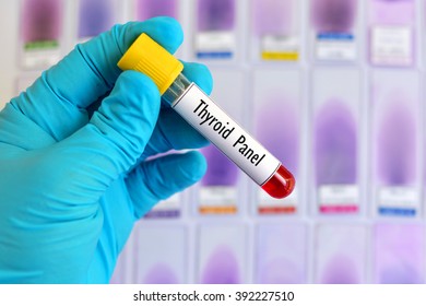 Blood Sample Thyroid Panel Test Stock Photo 392227510 | Shutterstock