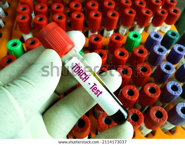 Blood Sample Torch Test Torch Panel Stock Photo 2114173037 | Shutterstock