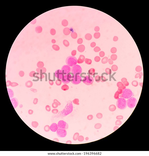 Blood Smear Under Microscope Stock Photo 196396682 | Shutterstock