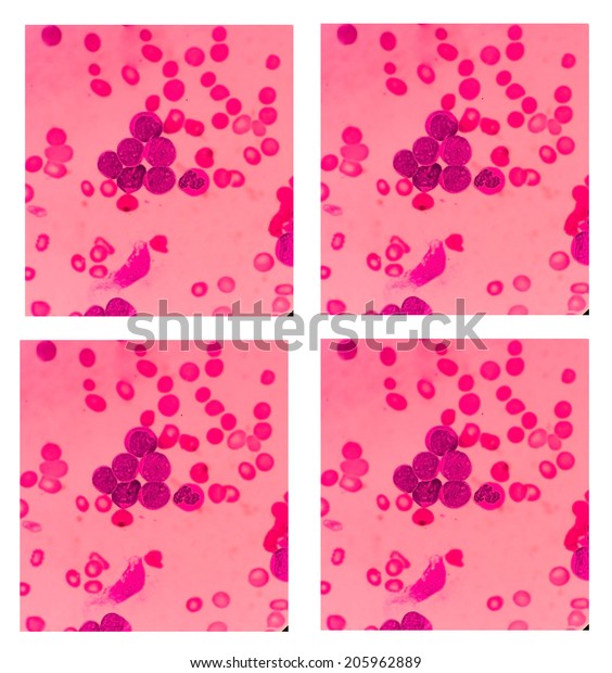 Blood Smear Under Microscope Stock Photo 205962889 | Shutterstock