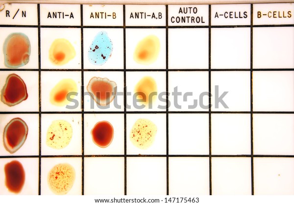 Blood Type Test Stock Photo 147175463 | Shutterstock