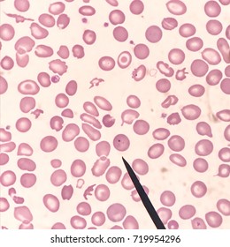 8 Howell jolly bodies Images, Stock Photos & Vectors | Shutterstock