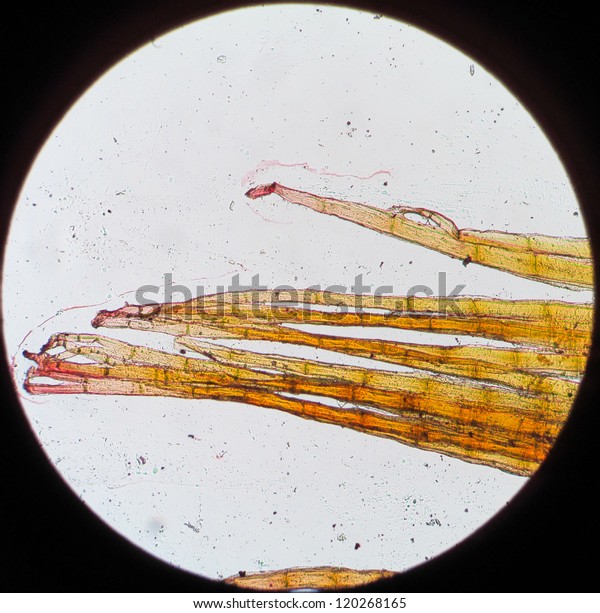 Bone Fish Which Classification Indicators Stock Photo 120268165 ...