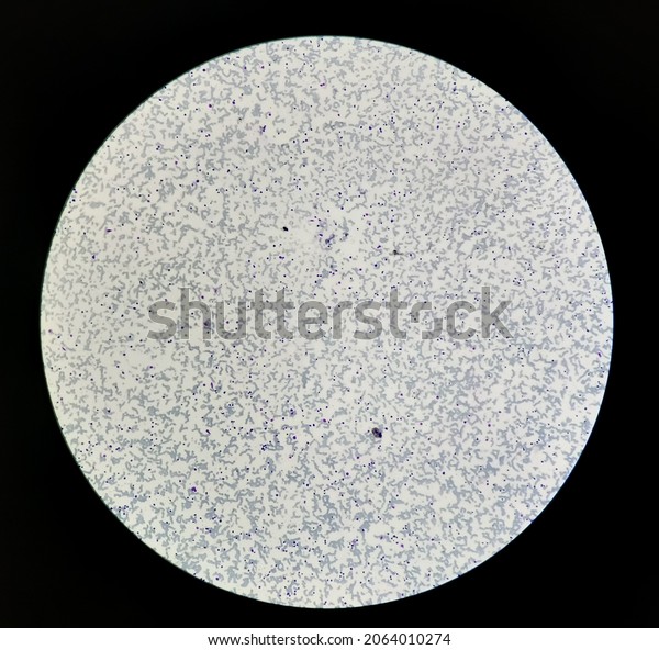 Bone Marrow Smear Microscopic Study Stock Photo 2064010274 | Shutterstock