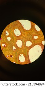 Osteon Images, Stock Photos & Vectors | Shutterstock
