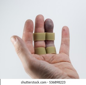 3,687 Bruise finger Images, Stock Photos & Vectors | Shutterstock