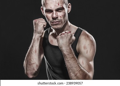 1,057 Boxer Bruise Stock Photos, Images & Photography | Shutterstock