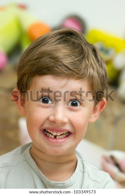 Boy Smiling Without One Teeth Stock Photo (Edit Now) 103349573