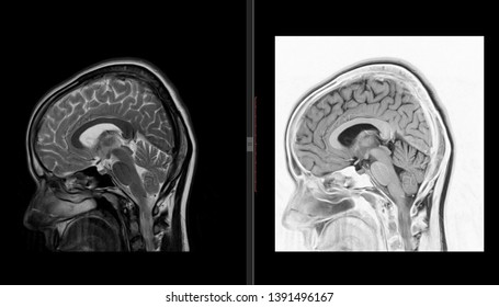 Brain Mri Scan High Resolution Head Stock Photo 1391496167 | Shutterstock