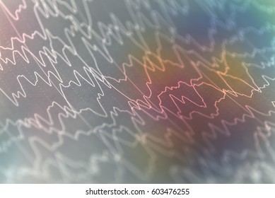 Brain Wave On Eeg Background Electroencephalogram Stock Photo 603476255 ...
