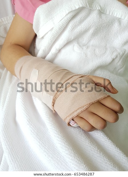 Broken Arm Cast Stock Photo 653486287 | Shutterstock
