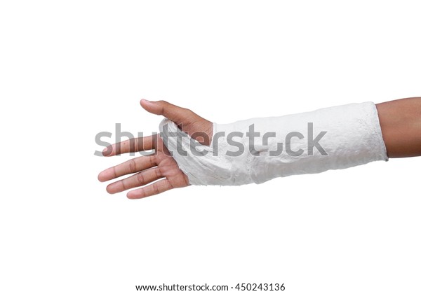 Broken Arm Plaster Cast Isolated On Stock Photo 450243136 | Shutterstock
