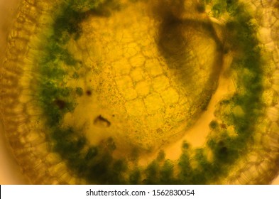 Bryophyte Leaf Under Microscope Chloroplasts Observed Foto de stock ...