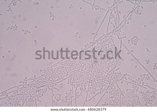 Budding Yeast Cell Structure Fine Microscope Stock Photo 680628379 ...