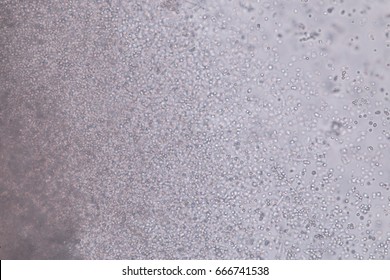 Budding Yeast Cell Under Microscope Stock Photo (Edit Now) 666741538