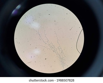 Budding Yeast Pseudohyphae Under Microscope Stock Photo 1988507828 ...