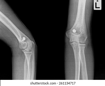 267 Bullet x ray Images, Stock Photos & Vectors | Shutterstock