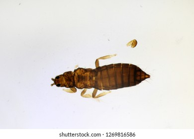 Cabbage Thrips Thrips Angusticeps Under Microscope Foto de stock ...