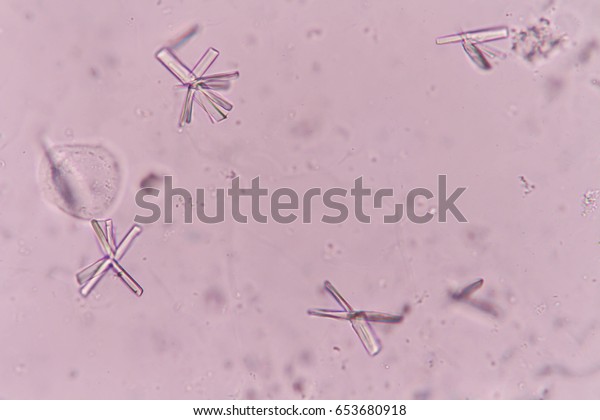63 Amorphous phosphates: immagini, foto stock e grafica vettoriale ...