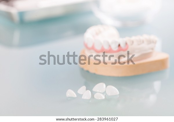Cast Tooth Stock Photo (Edit Now) 283961027