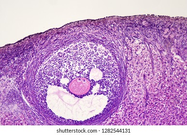 571 Cats Ovary Images, Stock Photos & Vectors | Shutterstock