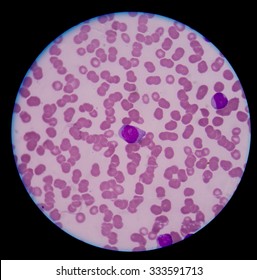 Platelet Satellitosis Phenomenon Polymorphonuclear Cell Moon Foto Stok ...