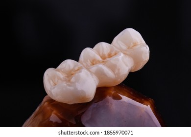 345 Implant Shells Images, Stock Photos & Vectors | Shutterstock