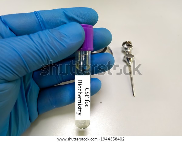 Cerebro Spinal Fluid Csf Sample Lumber Stock Photo 1944358402 ...