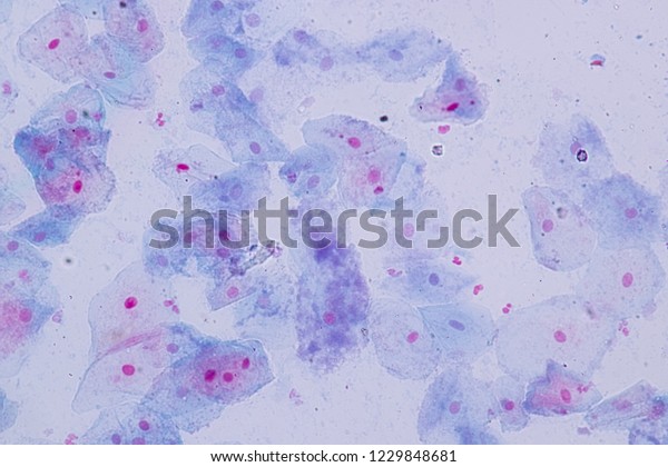 Characteristics Squamous Epithelial Cell Cell Structure库存照片1229848681 ...