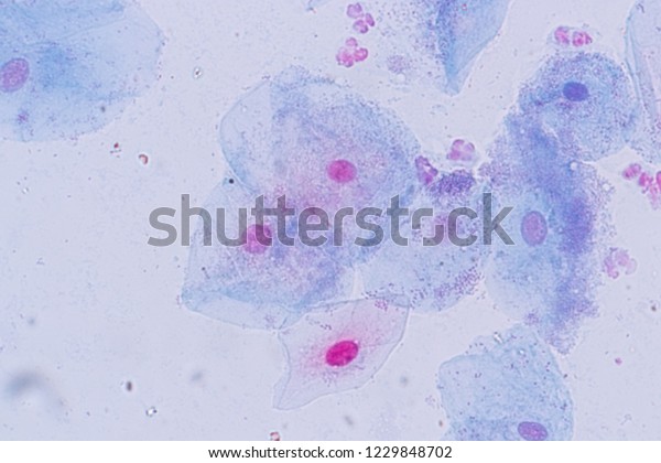 Characteristics Squamous Epithelial Cell Cell Structure Stock Photo ...