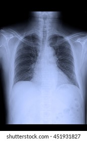 Xray Fat People写真素材1184774245 | Shutterstock