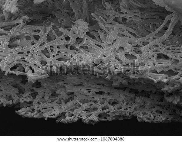 Chicken Eggshell Membrane Electron Microscopy Stock Photo 1067804888 ...