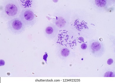 Human Chromosomes Blood Under Microscope View Stock Photo (Edit Now ...