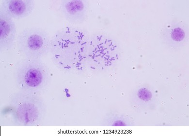 Chromosomes Human Under Microscope Education Lab Stock Photo 1235867521 ...
