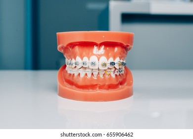 Dental Jaw Model Braces Brackets Stock Photo 581411413 | Shutterstock
