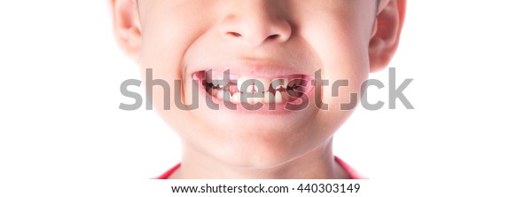 Close Kid Toothless Stock Photo 440303149 | Shutterstock